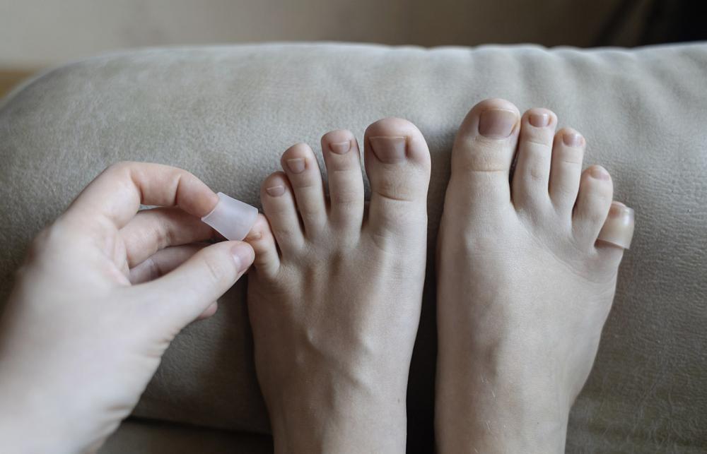 Hammer Toe Splints and Treatments - What Works, What Podiatrists Recommend