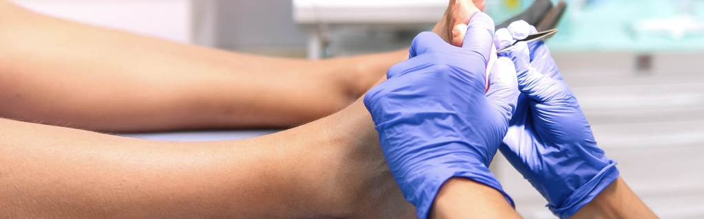 Podiatry Supplies & Equipment - Instruments, Blades, Dressings