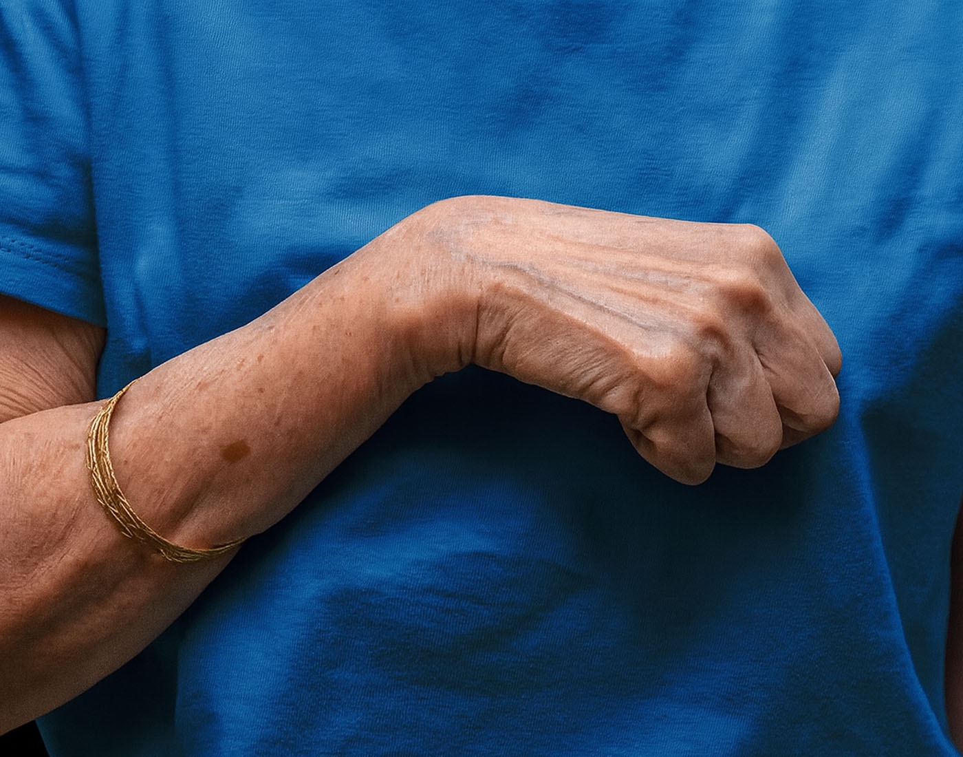 What is Contracture Management?