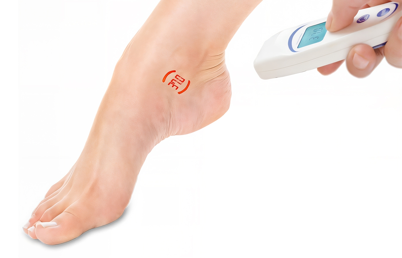How Foot Temperature can Indicate Diabetic Ulcer Formation | Algeos