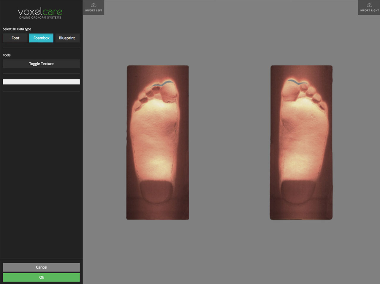 3D Printed Othotic Insoles | Algeos