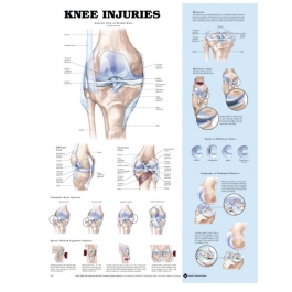 Knee Injuries Poster - Colour Chart - Paper Version | Algeos