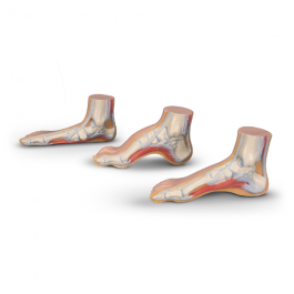 Set of Human Anatomical Foot Models - 3 Foot Types